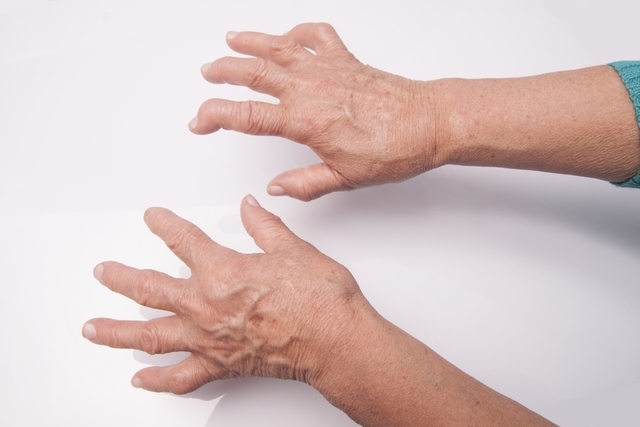 Colágeno Tipo 2 Cartilax: efeitos, benefícios e tudo sobre ele!