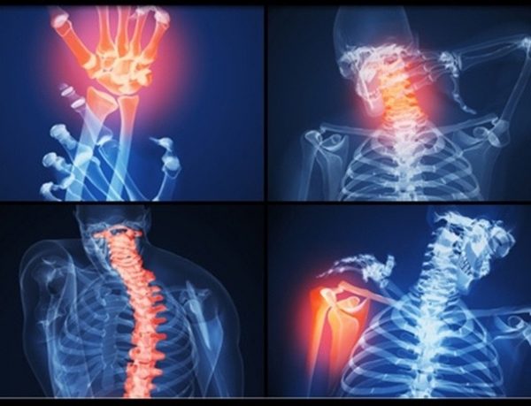 Colágeno Tipo 2 Cartilax: efeitos, benefícios e tudo sobre ele!