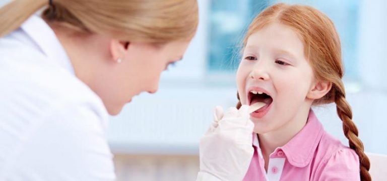 Amigdalite: por que ocorre? Sintomas e Como Tratam